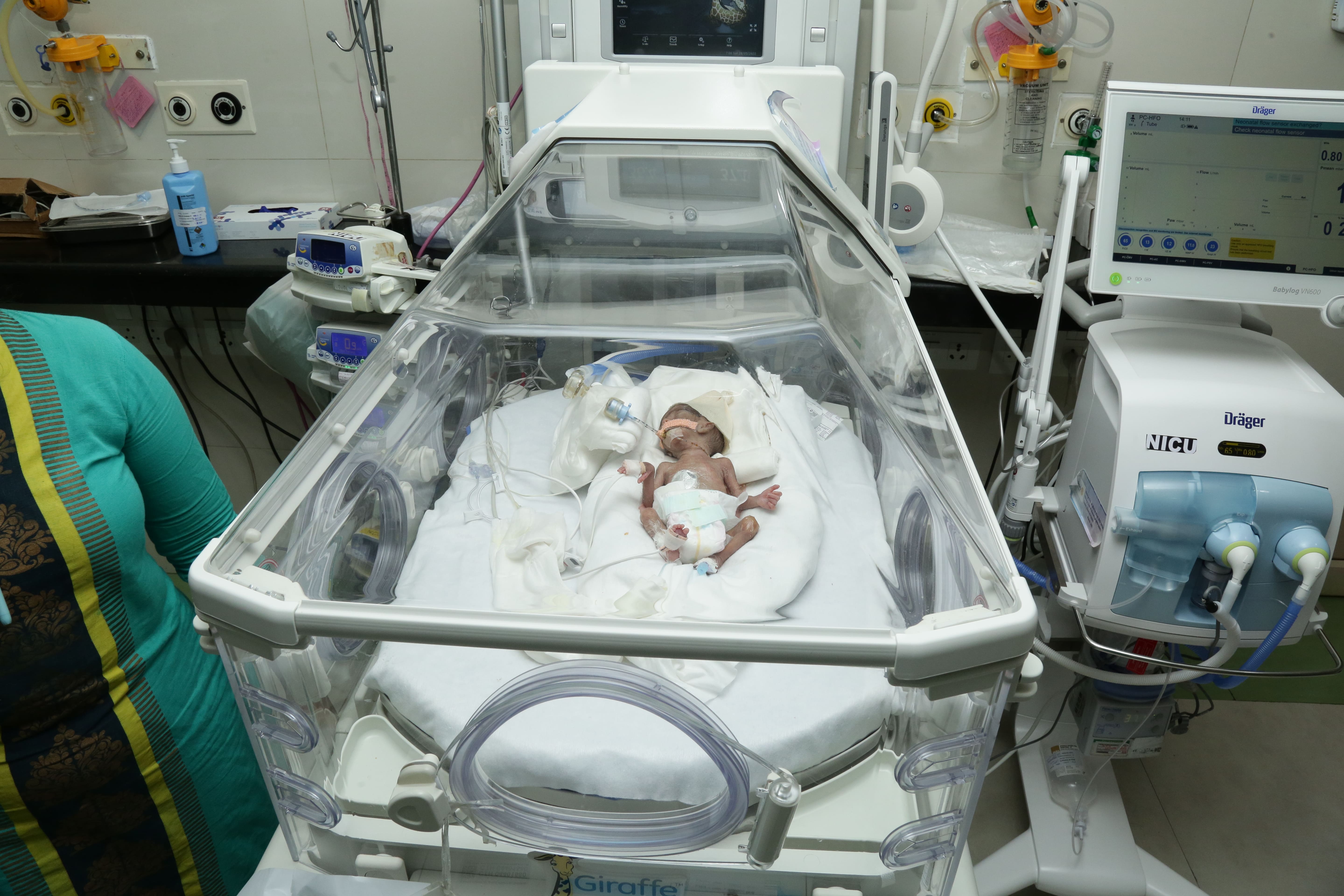 Kanchi Kamakoti CHILDS Trust Hospitals